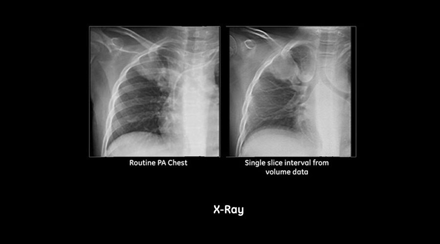 VolumeRAD | GE Healthcare