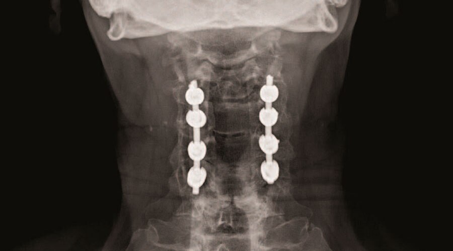 Discovery RF180 Radiography and Fluoroscopy System | GE Healthcare