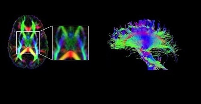 SIGNA™ PET/MR with QuantWorks – 60cm | GE Healthcare