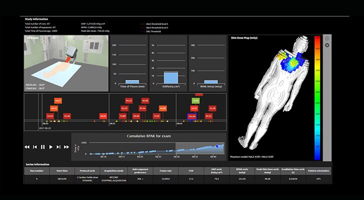 DoseWatch | Dose Monitoring Software | GE Healthcare | GE Healthcare