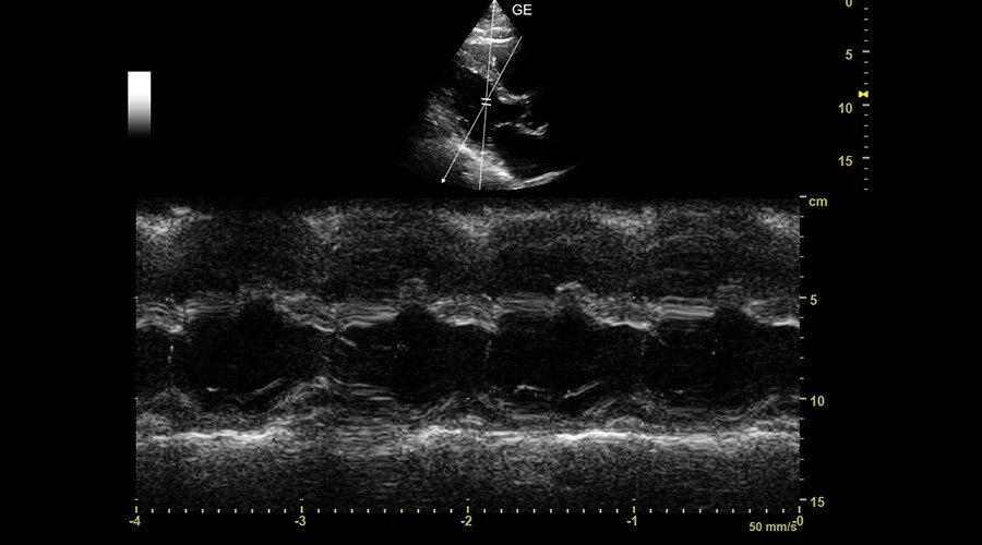 Versana Balance | GE Healthcare