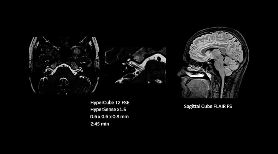 SIGNA™ Premier – 70cm | GE Healthcare