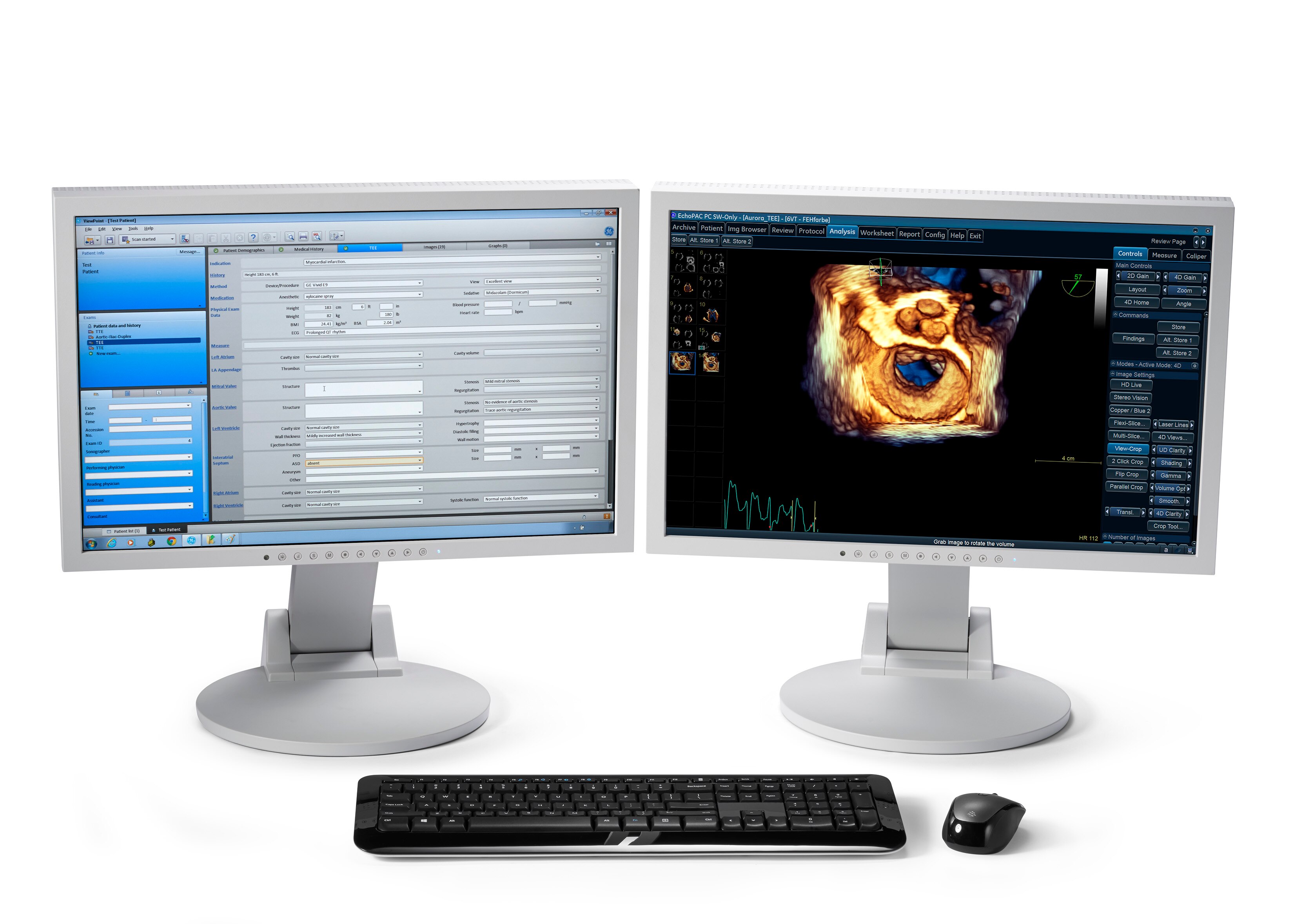 Vivid S70 | GE Healthcare