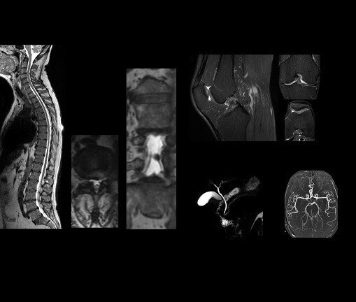 SIGNA™ PET/MR with QuantWorks – 60cm | GE Healthcare