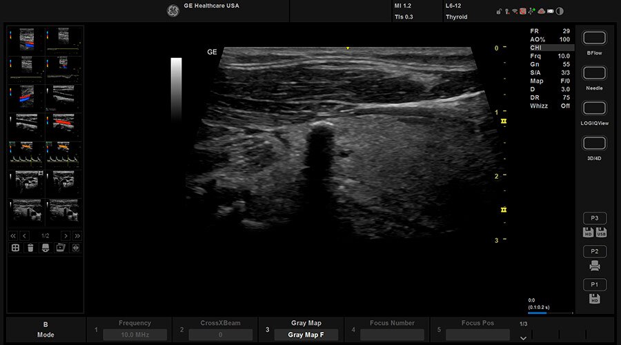 Versana Balance | GE Healthcare