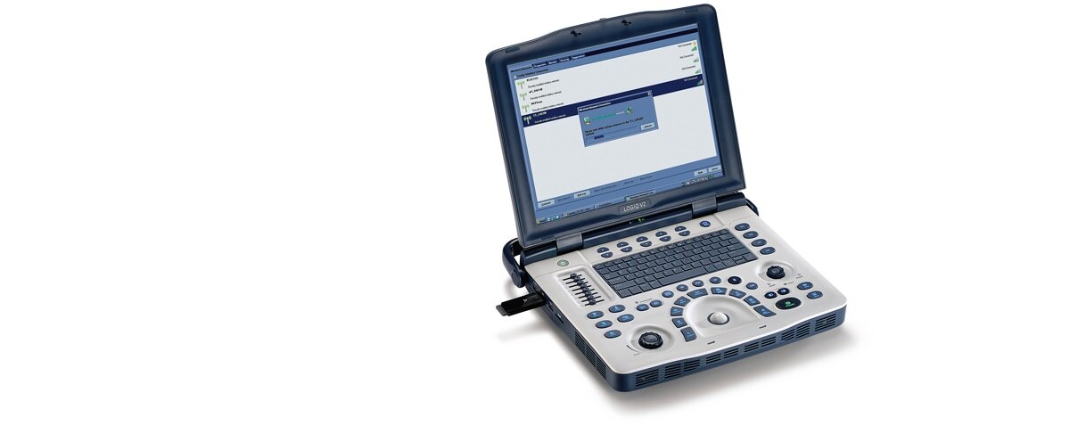 LOGIQ V2 | GE Healthcare