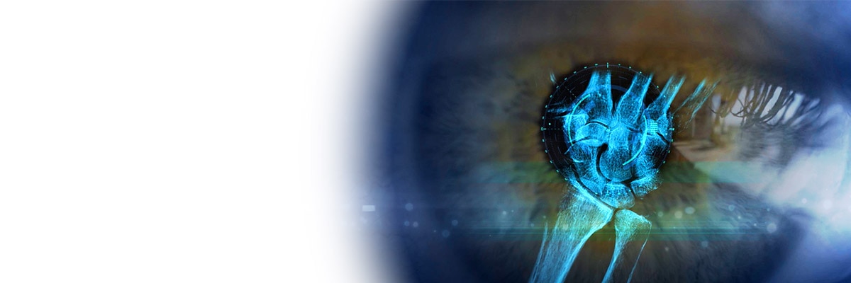 Radiography X-Ray Machines | GE Healthcare (India)