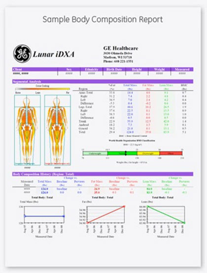 Composer Reporting | GE Healthcare (India)