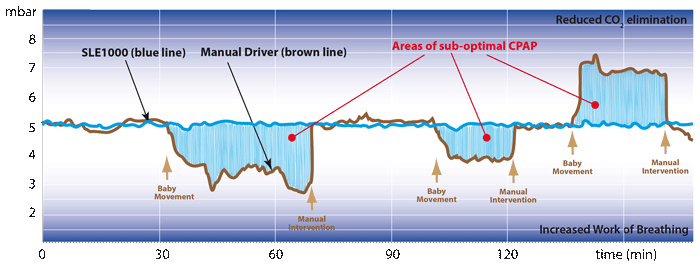 sle1000 | GE Healthcare (India)