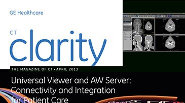 AW Server Integration with PACS | GE Healthcare (India)