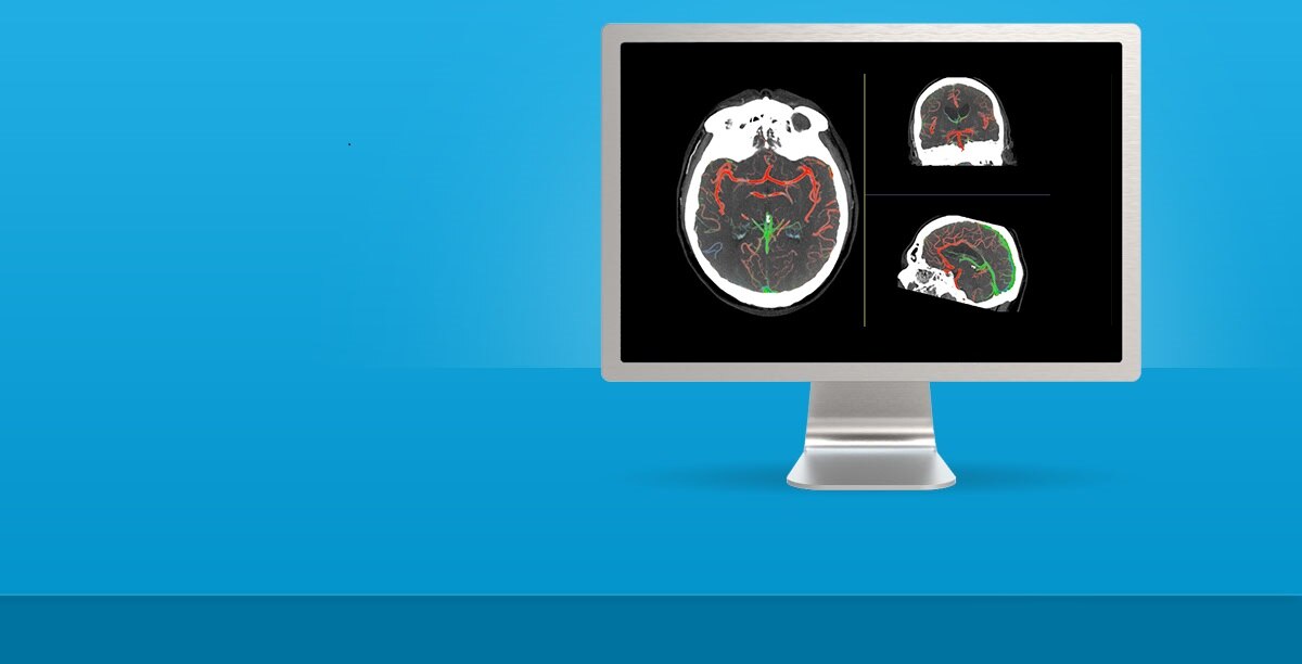 FastStroke | GE Healthcare (India)