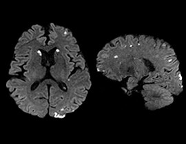 eDWI | GE HealthCare (India)