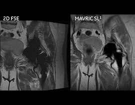 MAVRIC SL | GE HealthCare (India)