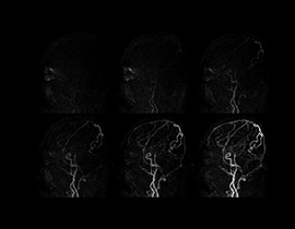 TRICKS | GE HealthCare (India)