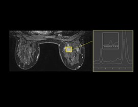 BREASE | GE HealthCare (India)