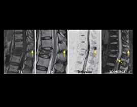 MERGE | GE HealthCare (India)