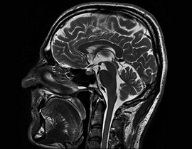 PROPELLER | GE HealthCare (India)