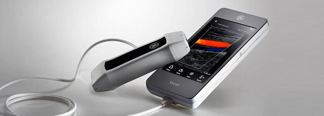 Point of Care Ultrasound Machines | GE Healthcare