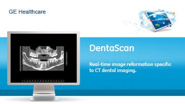 DentaScan | GE Healthcare (India)