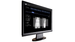 Dose Management IHE Integration Statements | GE HealthCare (India)