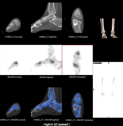 Clinical Image Library - Optima NM/CT 640 - GENERAL PURPOSE HYBRID ...