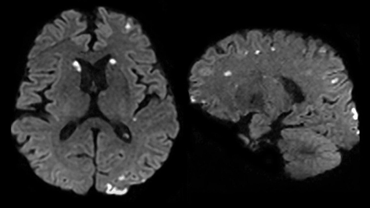 Neuro Imaging | GE Healthcare (India)