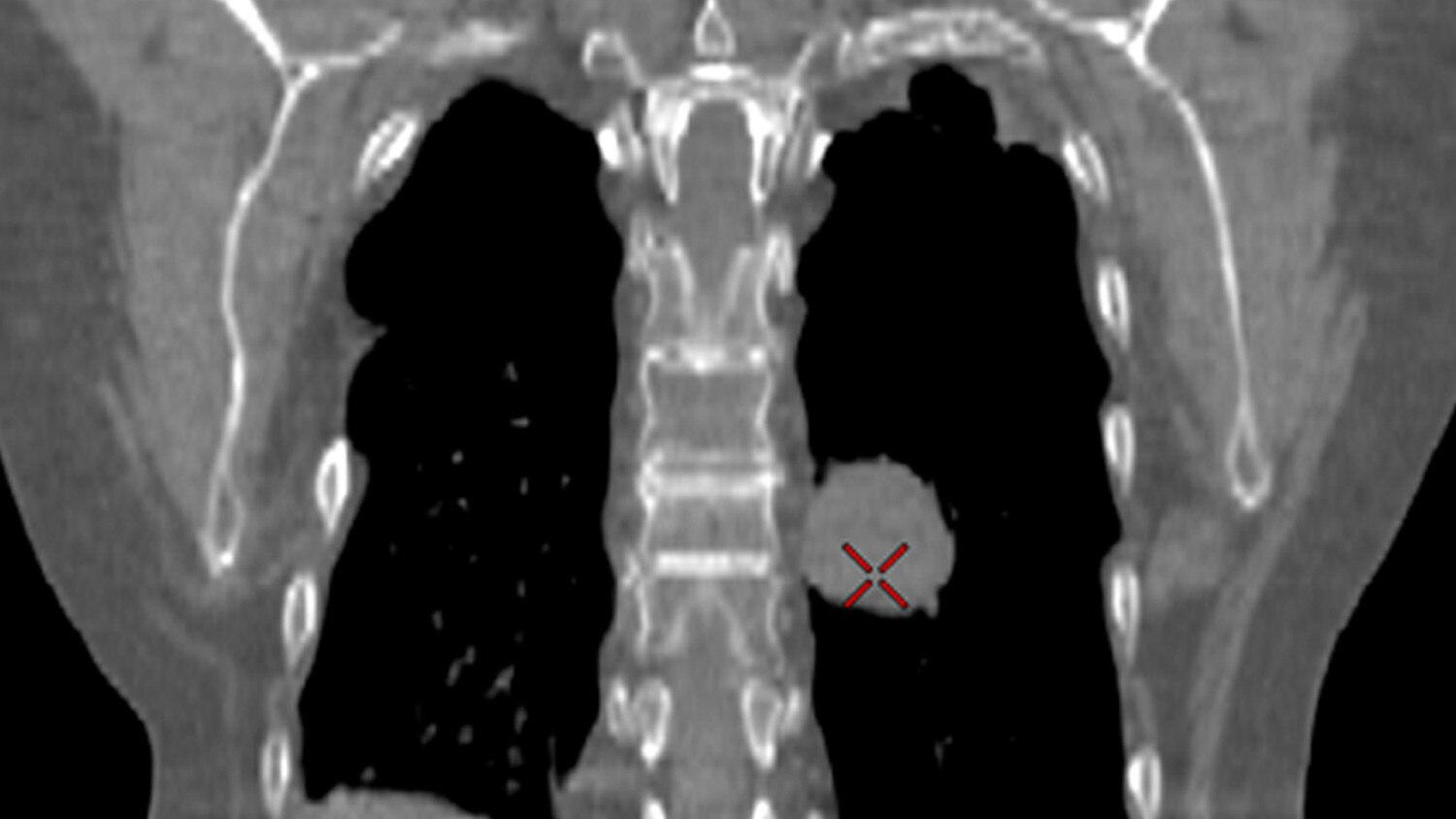 CT Advanced Visualization | GE Healthcare (India)