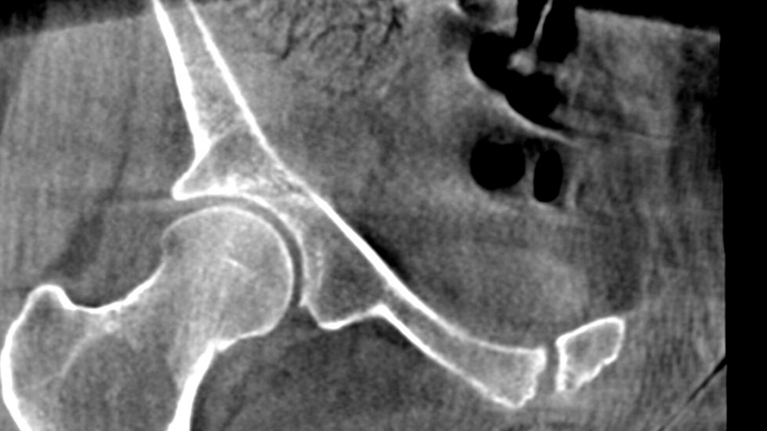 Interventional Advanced Visualization | GE Healthcare (India)