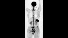 eDWI | GE HealthCare (India)