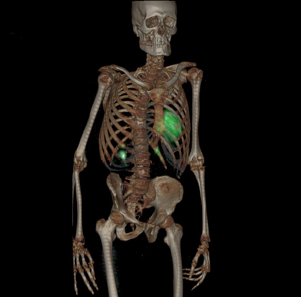 Volume Viewer | GE Healthcare (India)