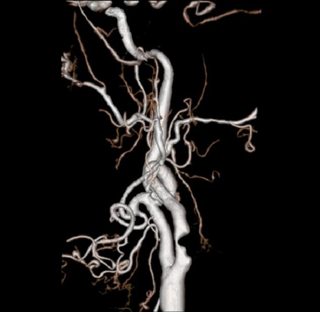 Innova 3D | GE Healthcare (India)