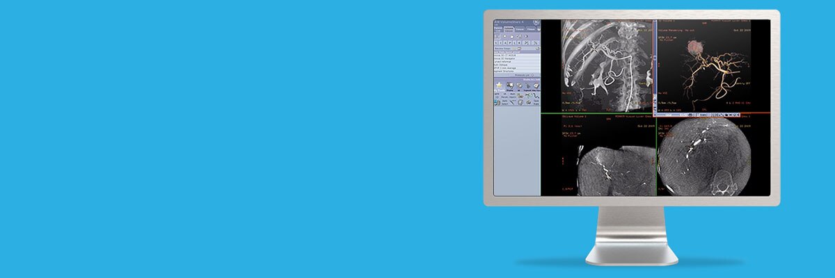 Innova 3D | GE Healthcare (India)