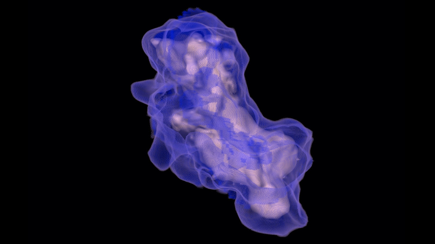 Oncology Advanced Visualization | GE Healthcare (India)