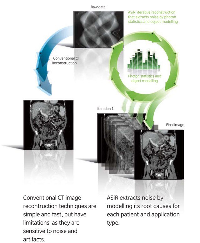ASiR | GE Healthcare (India)